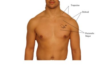 Surface Anatomy – Advanced Anatomy 2nd. Ed.