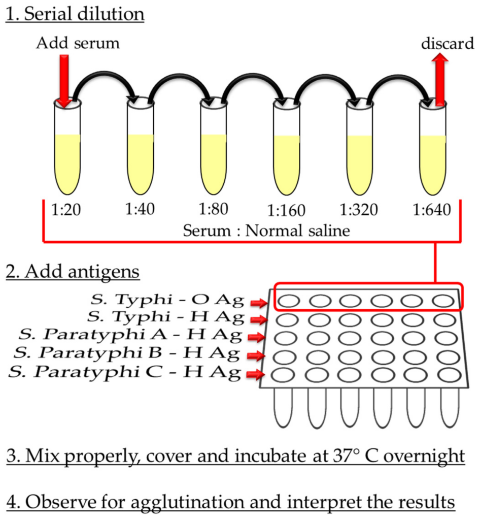 Appendix: Summary of Lab Diagnostics using Immunological Techniques ...