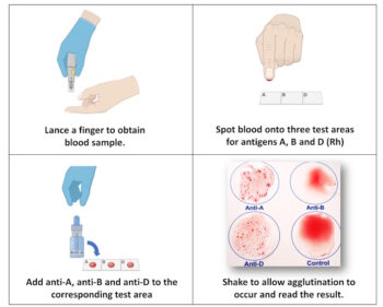 Appendix: Summary of Lab Diagnostics using Immunological Techniques ...
