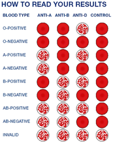 Appendix: Summary of Lab Diagnostics using Immunological Techniques ...