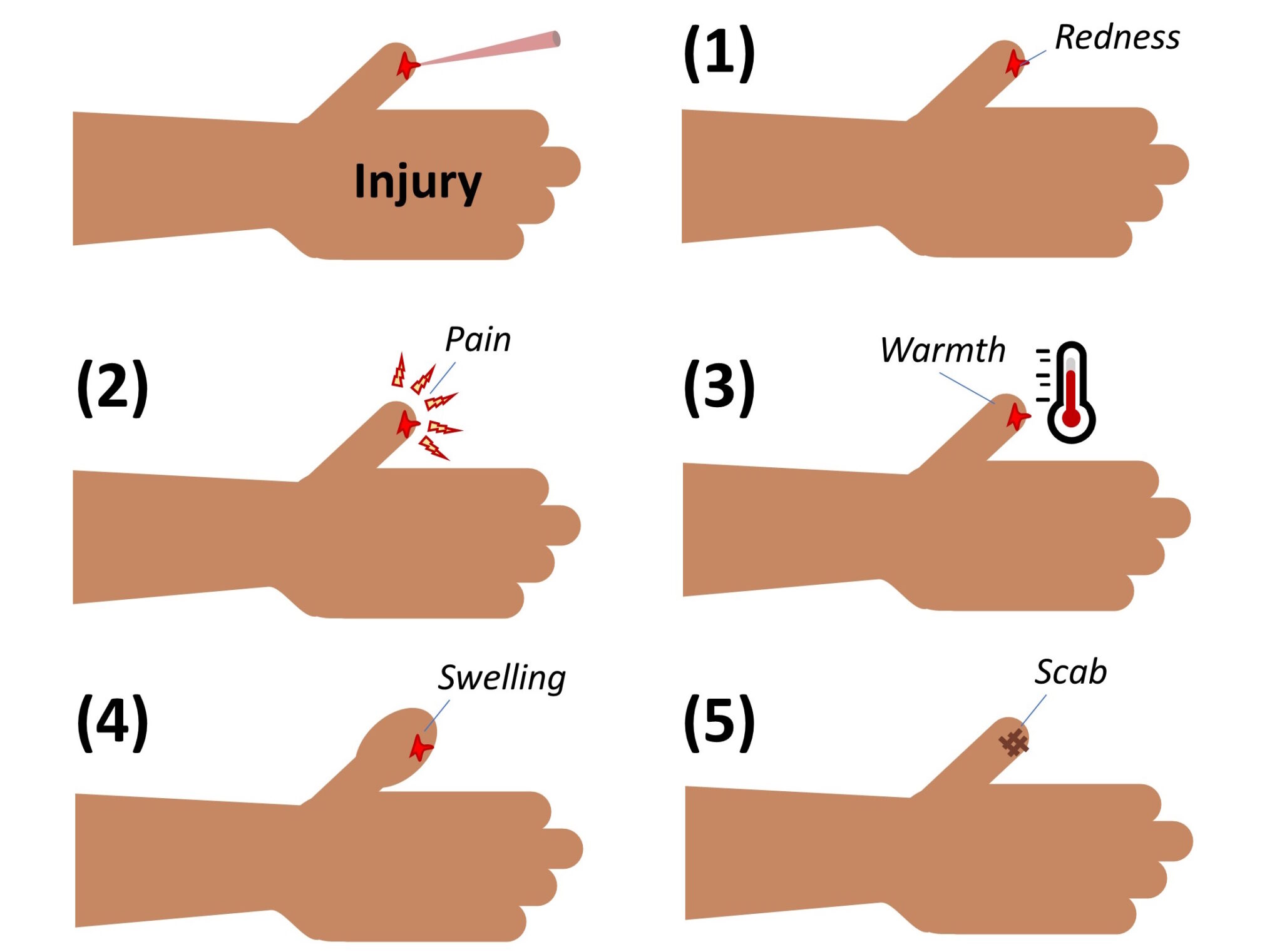 Chapter 3 Induced Innate Immune Responses – Basic Concepts in Applied ...