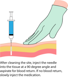 7.5 Intramuscular Injections – Clinical Procedures for Safer Patient Care