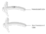 10.5 Tracheostomies – Clinical Procedures for Safer Patient Care