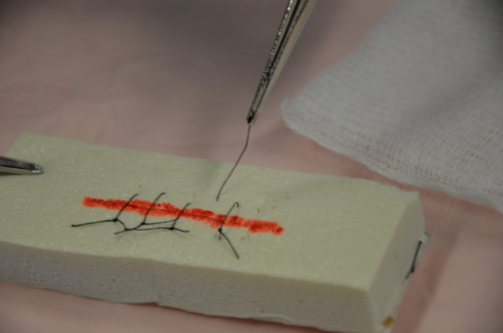4.7 Suture Removal – Clinical Procedures for Safer Patient Care
