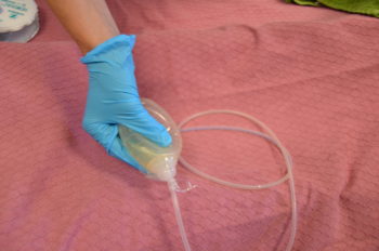 4.9 Drain Management and Removal – Clinical Procedures for Safer ...