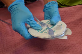 4.9 Drain Management and Removal – Clinical Procedures for Safer ...