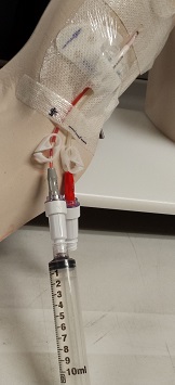 8.8 Flushing and Locking PVAD-Short, Midlines, CVADs (PICCs ...