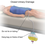 Head-to-Toe Assessment: Genitourinary Assessment