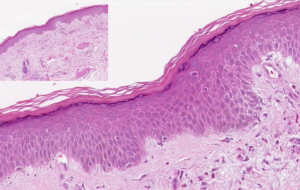 Unit 11: The Integumentary System – Douglas College Human Anatomy ...