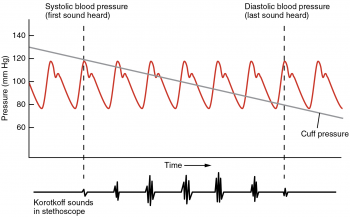 Unit 4: Blood Vessels and Circulation – Douglas College Human Anatomy ...