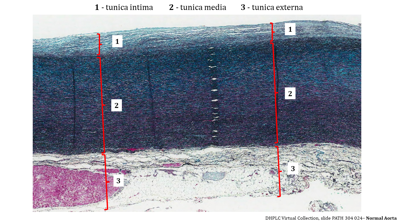 Gross Anatomy and Histology of Normal Aorta – Pathology