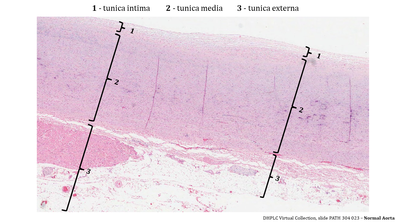 Gross Anatomy and Histology of Normal Aorta – Pathology