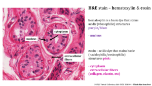 Gross Anatomy and Histology of Normal Aorta – Pathology