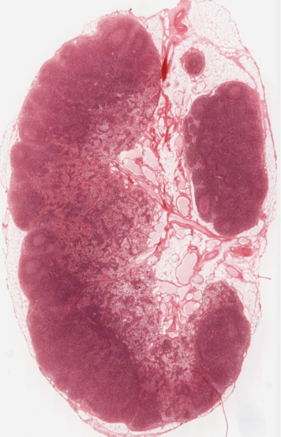 Lymphatic Organs and Tissues (Key Structural Components of the Immune ...