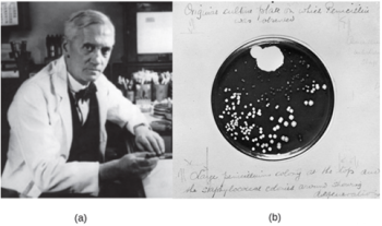 Unit 1.3 A Brief History of Microbiology – Introduction to Microbiology ...