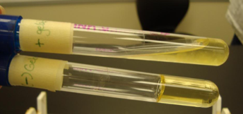 Unit 4 Characteristics of Microbes – Introduction to Microbiology for ...