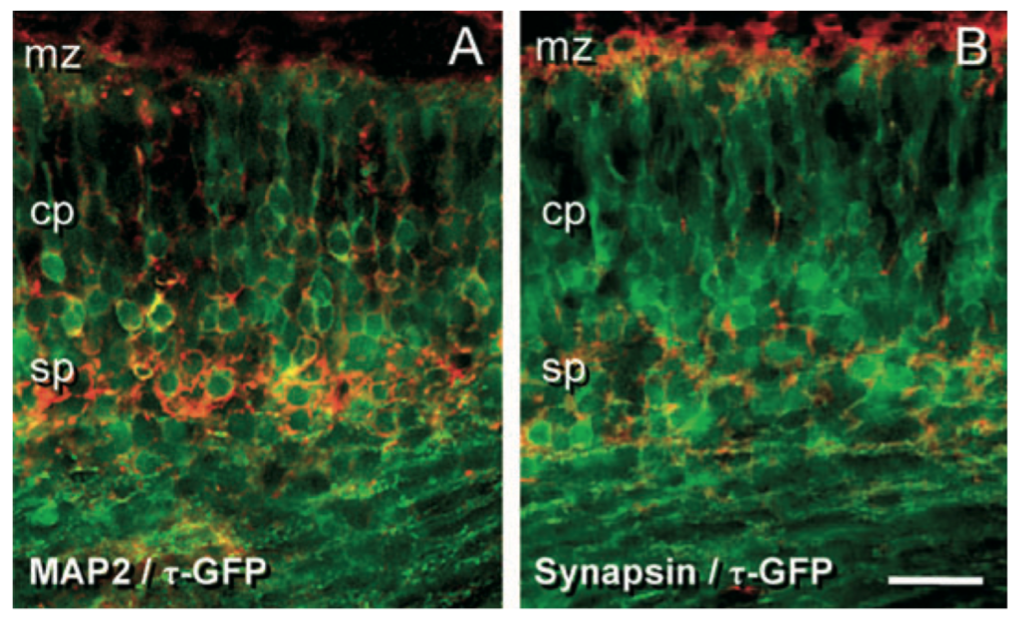 The GFP Project – Genetic Engineering: A Primer to Get You Started