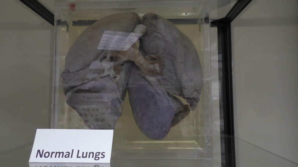 Video Lessons on Normal Anatomy and Histology of Lungs – Pathology