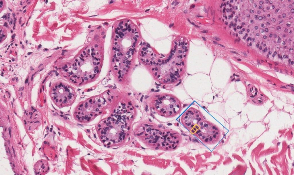 A New Learner’s Guide to Cell Morphology in Histology – Pathology